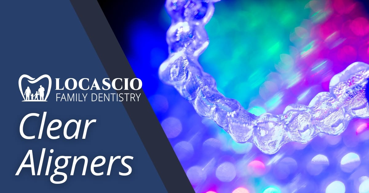 Invisalign, Orthodontics - Elk Grove - Dr. Locascio